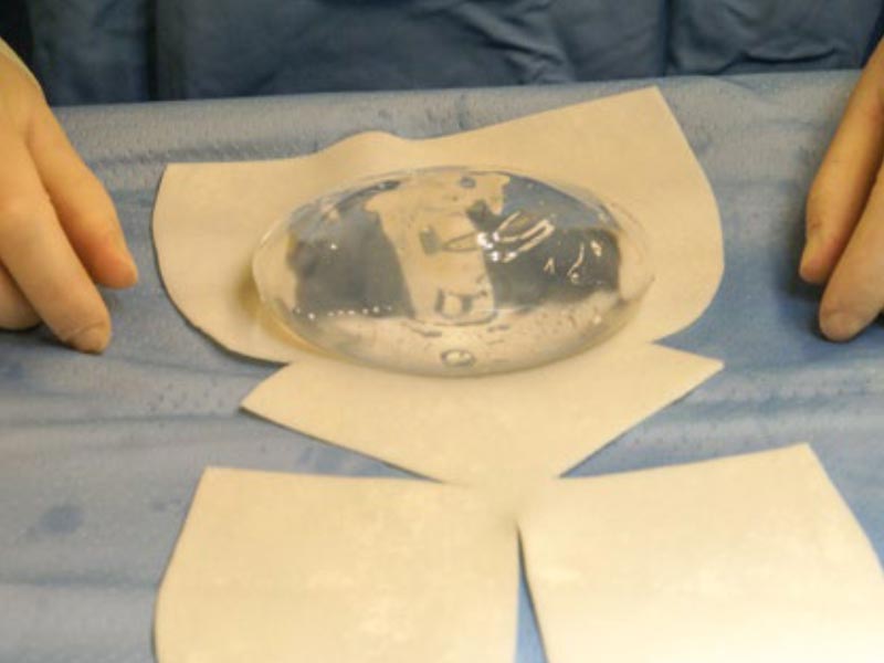 Braxon - Leap Biosurgical